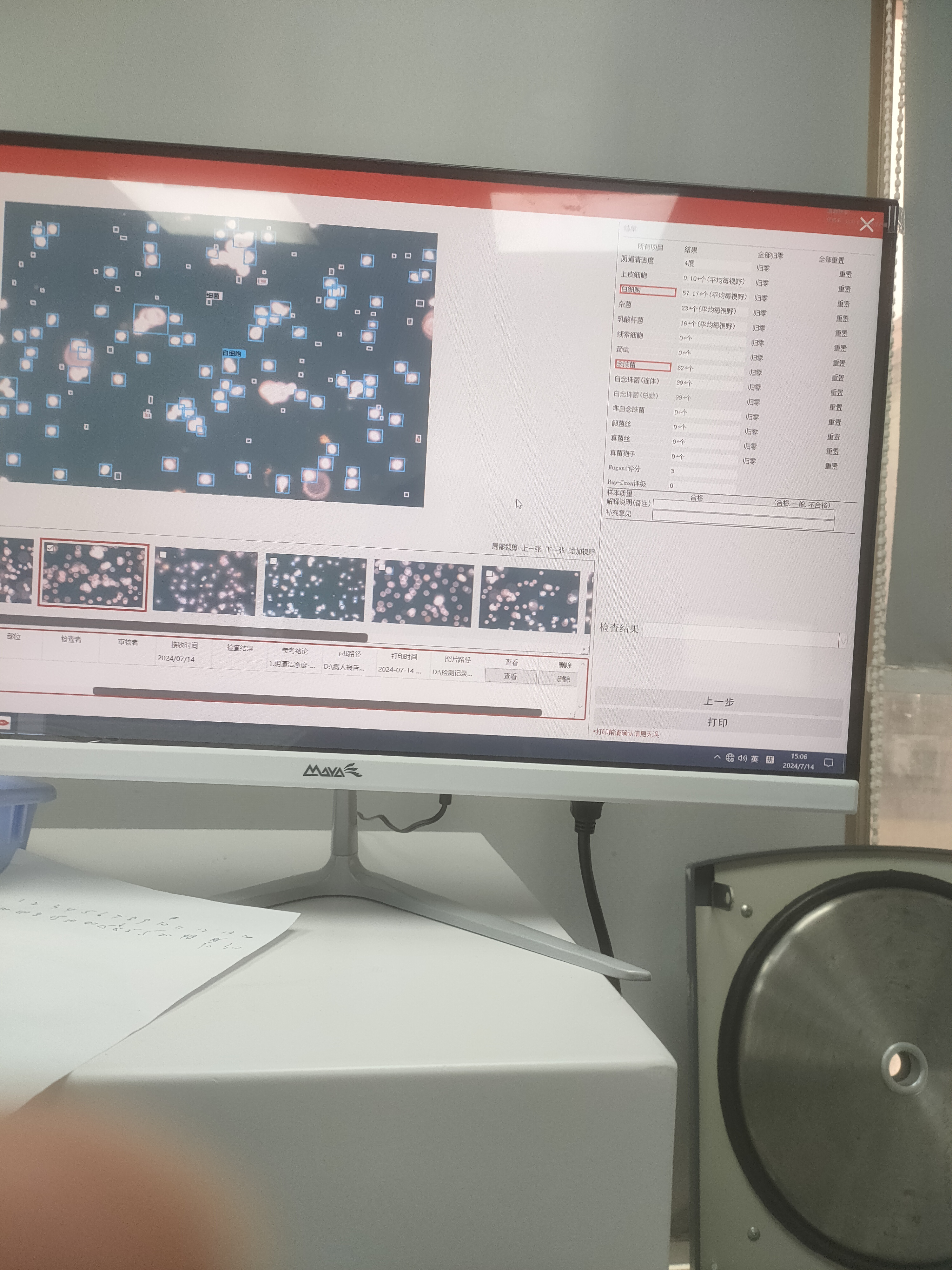 A New Choice for Women's Health Protection: ONEE's Fully Automatic ...